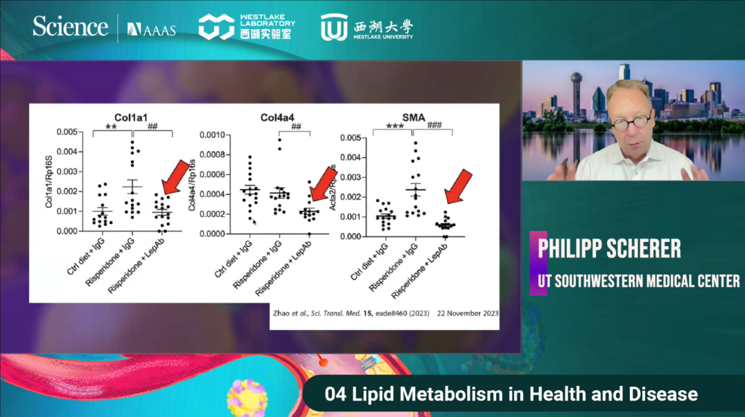 西湖实验室-精彩回顾 | 西湖-Science系列研讨会第④期：健康与疾病中的脂质代谢